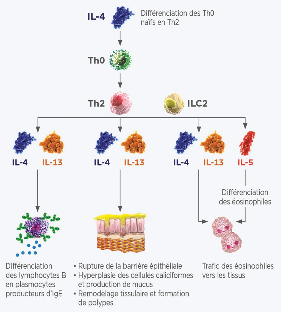 Polypose naso-sinusienne (PNS) et rôle de l’inflammation de type 2