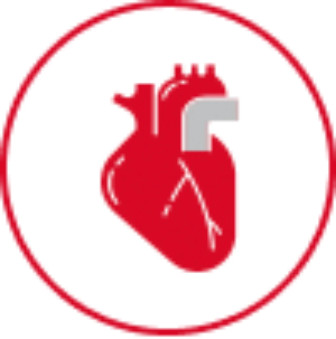 Signos y síntomas de la MPS-I