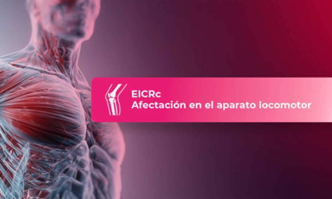 EICR Crónica en el aparato locomotor: guía y ejercicios