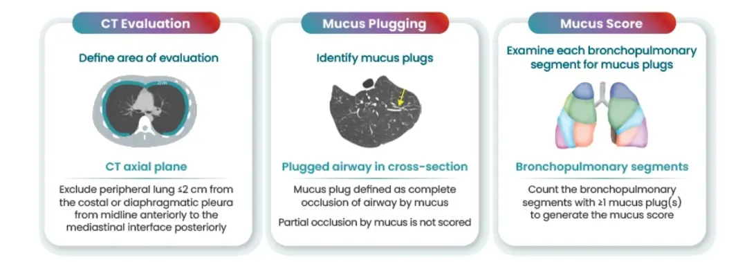 mucus plug lung causes