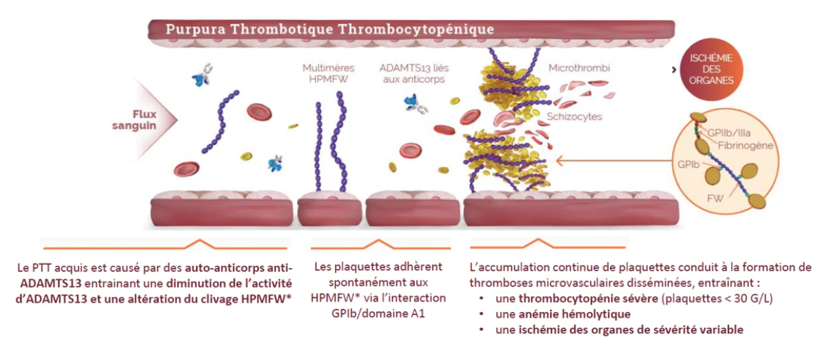 Microangiopathie Thrombotique – Physiopathologie du PTT