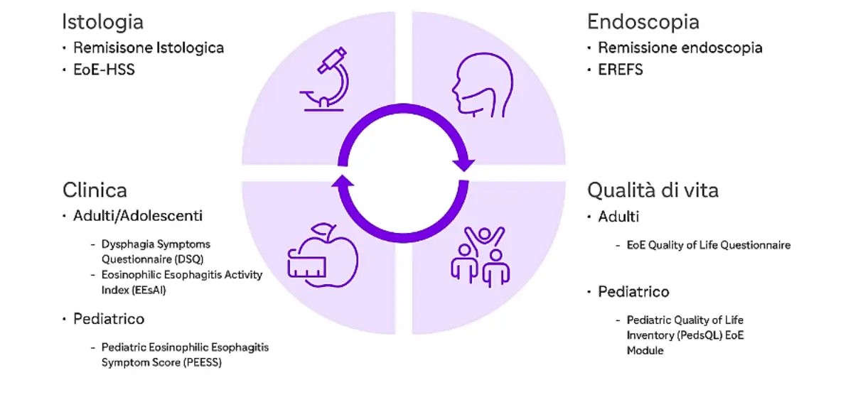 La diagnosi di Esofagite Eosinofila | Sanofi Campus Italia