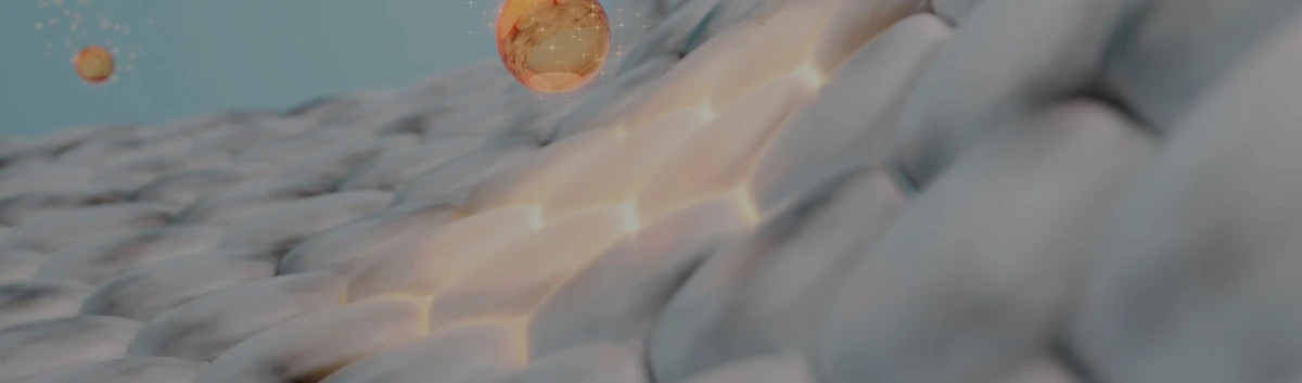 Tratamiento de dermatitis ezcema | Campus Sanofi