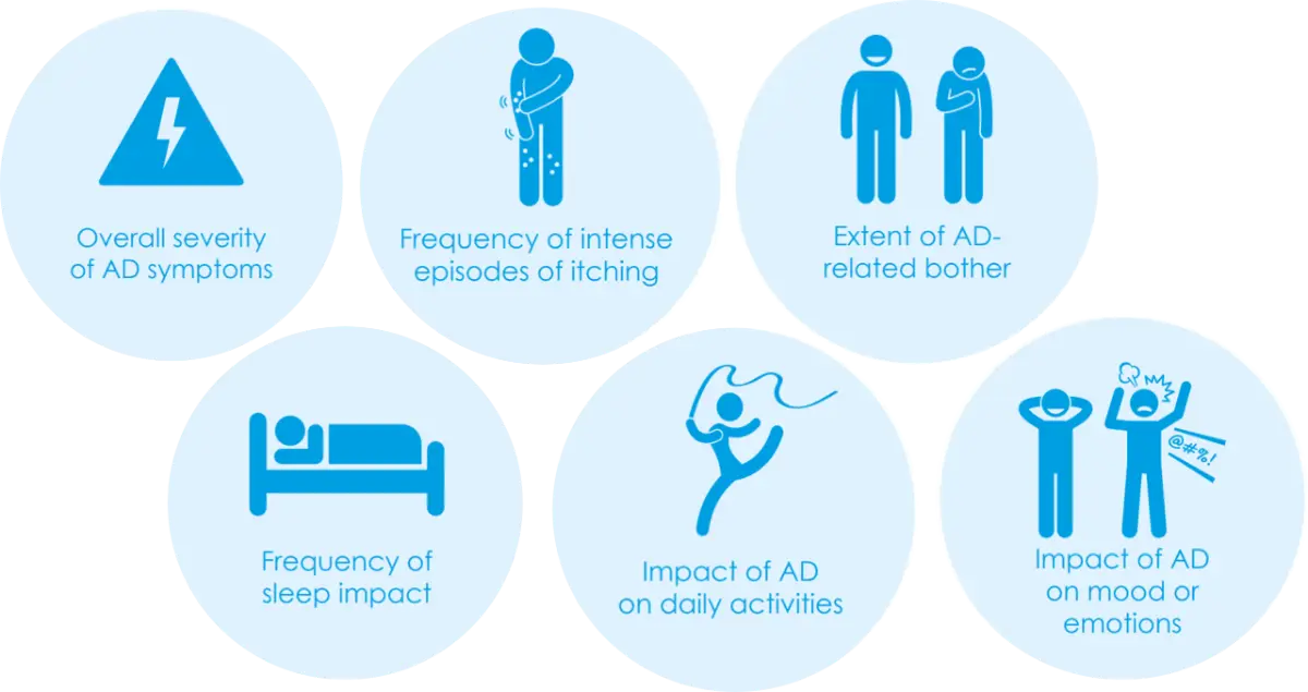 Atopic Dermatitis Control Tool (ADCT) – Sanofi Campus+ UK