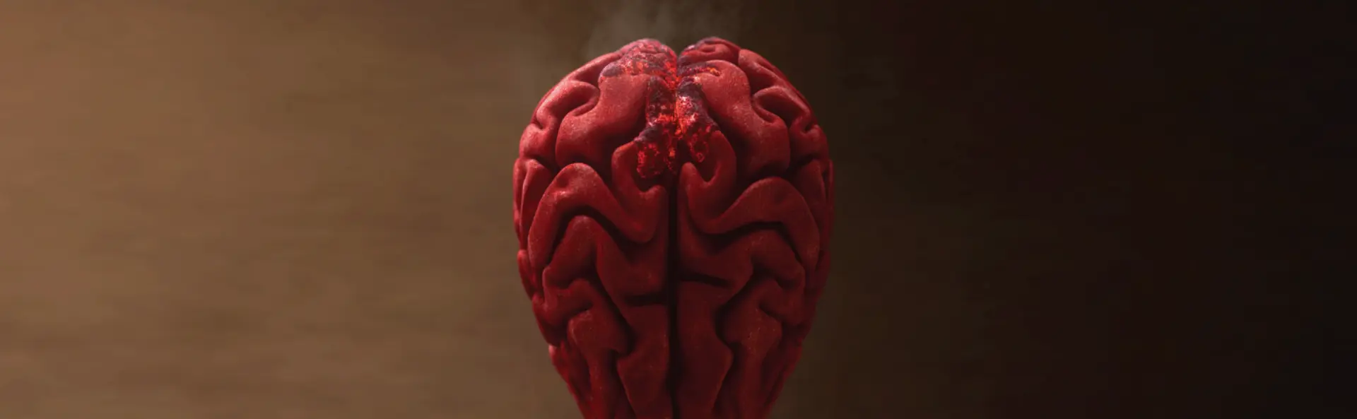 Physiopathologie de la Smoldering MS en vidéo