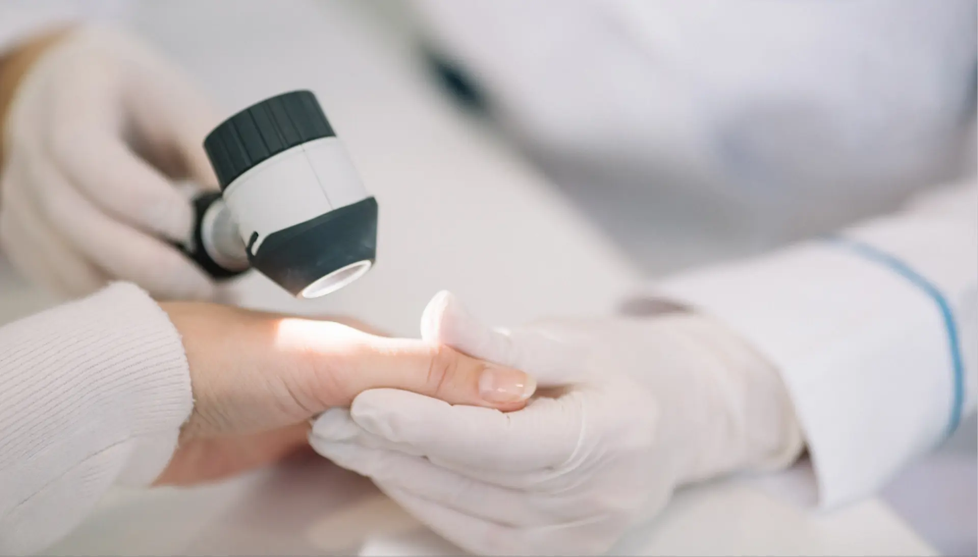 Dermatite Atopica | Campus Sanofi Italia