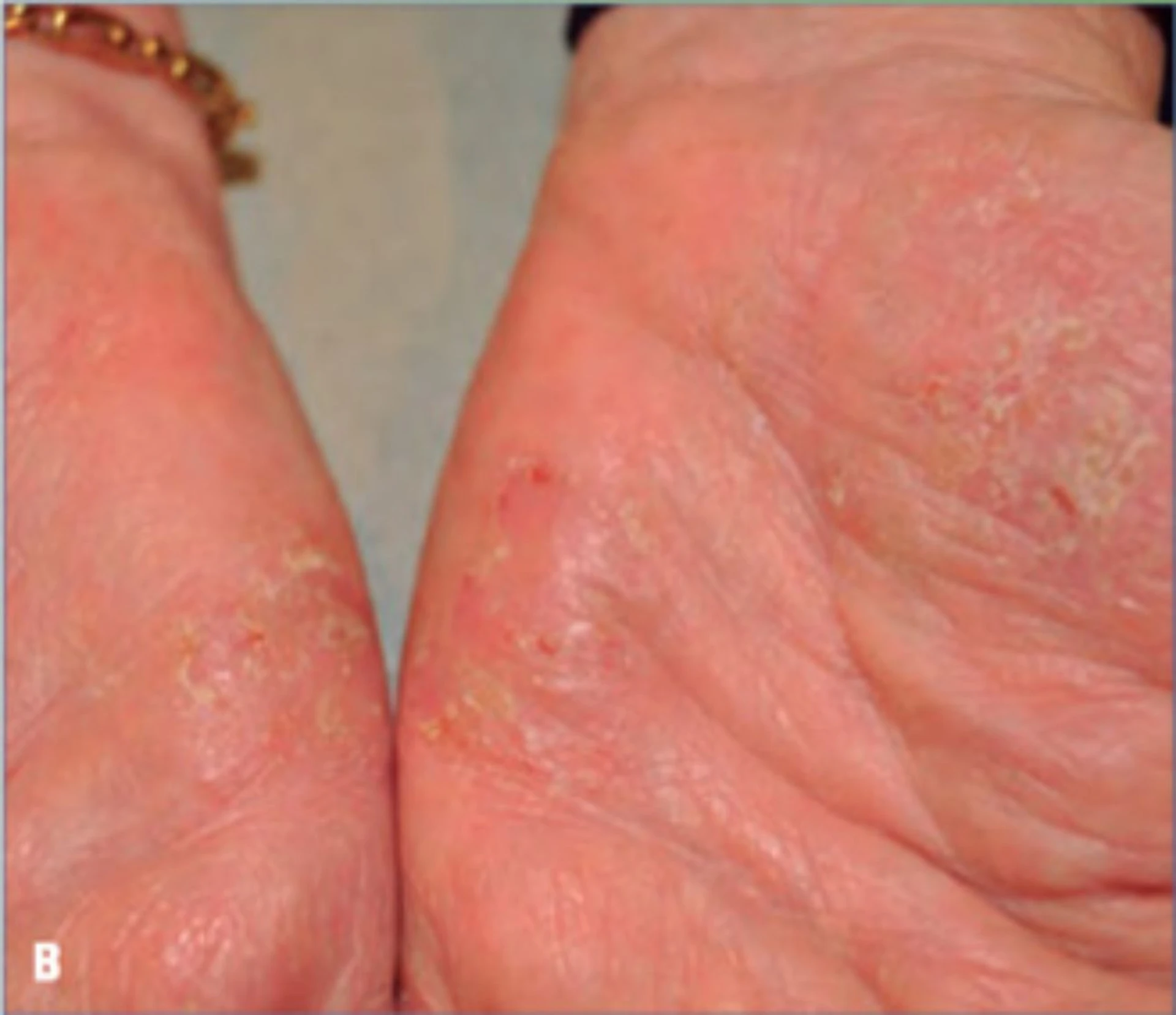 Principios básicos del tratamiento| Campus Sanofi