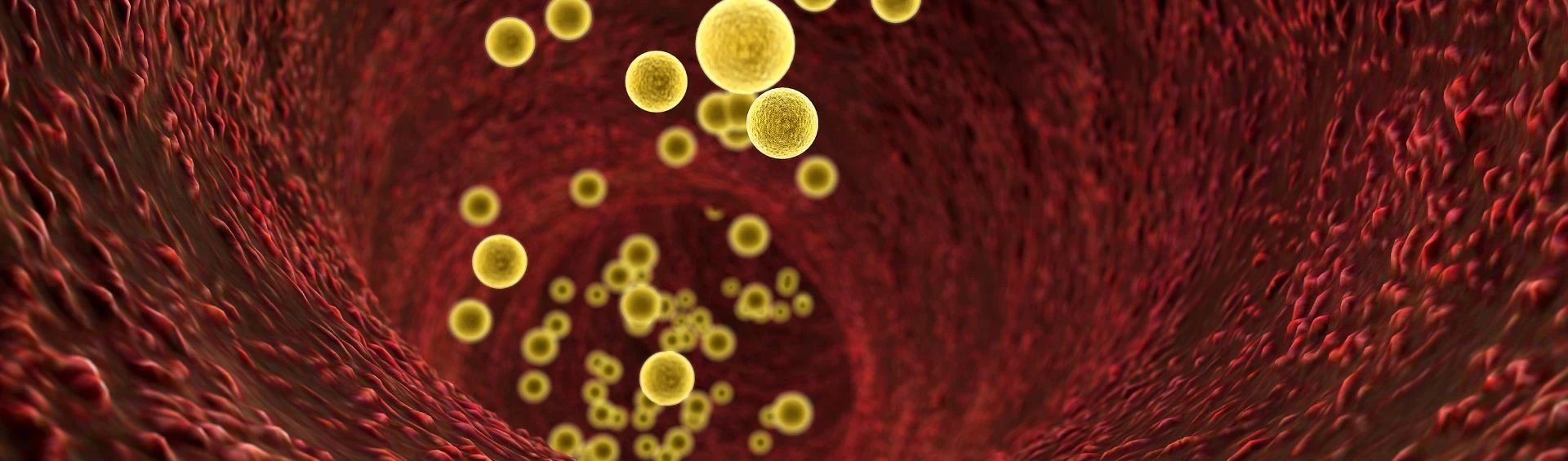 Inhibidores de PCSK9 | Campus Sanofi