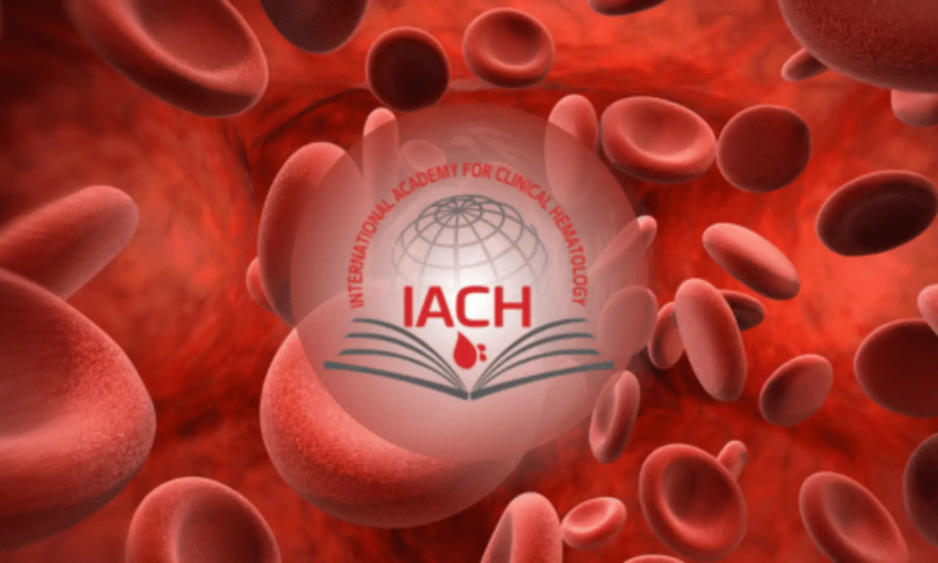 IACH Stem Cell Transplant Academy: Formación en trasplante de células madre