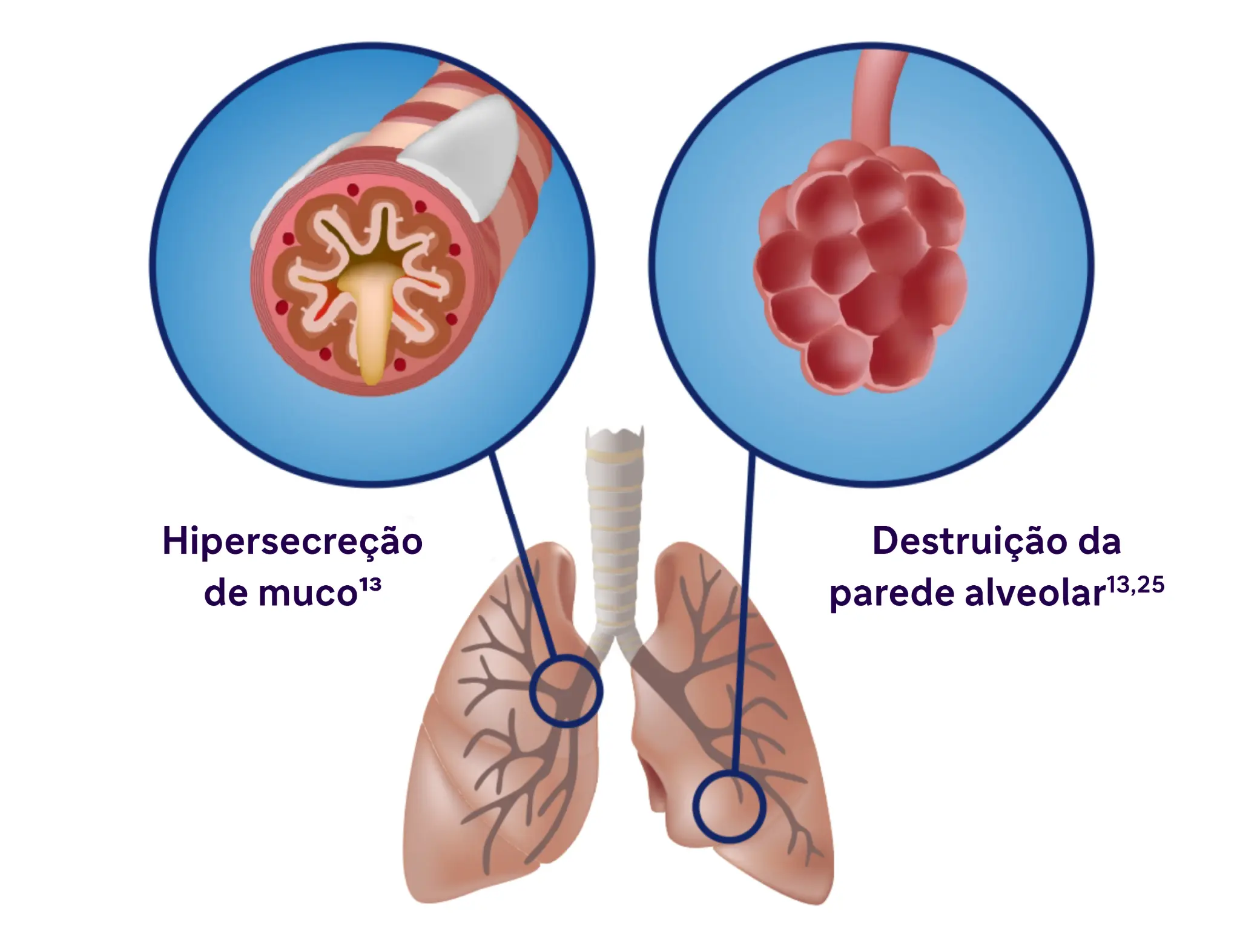 Papel da inflamação tipo 2 | Campus Sanofi