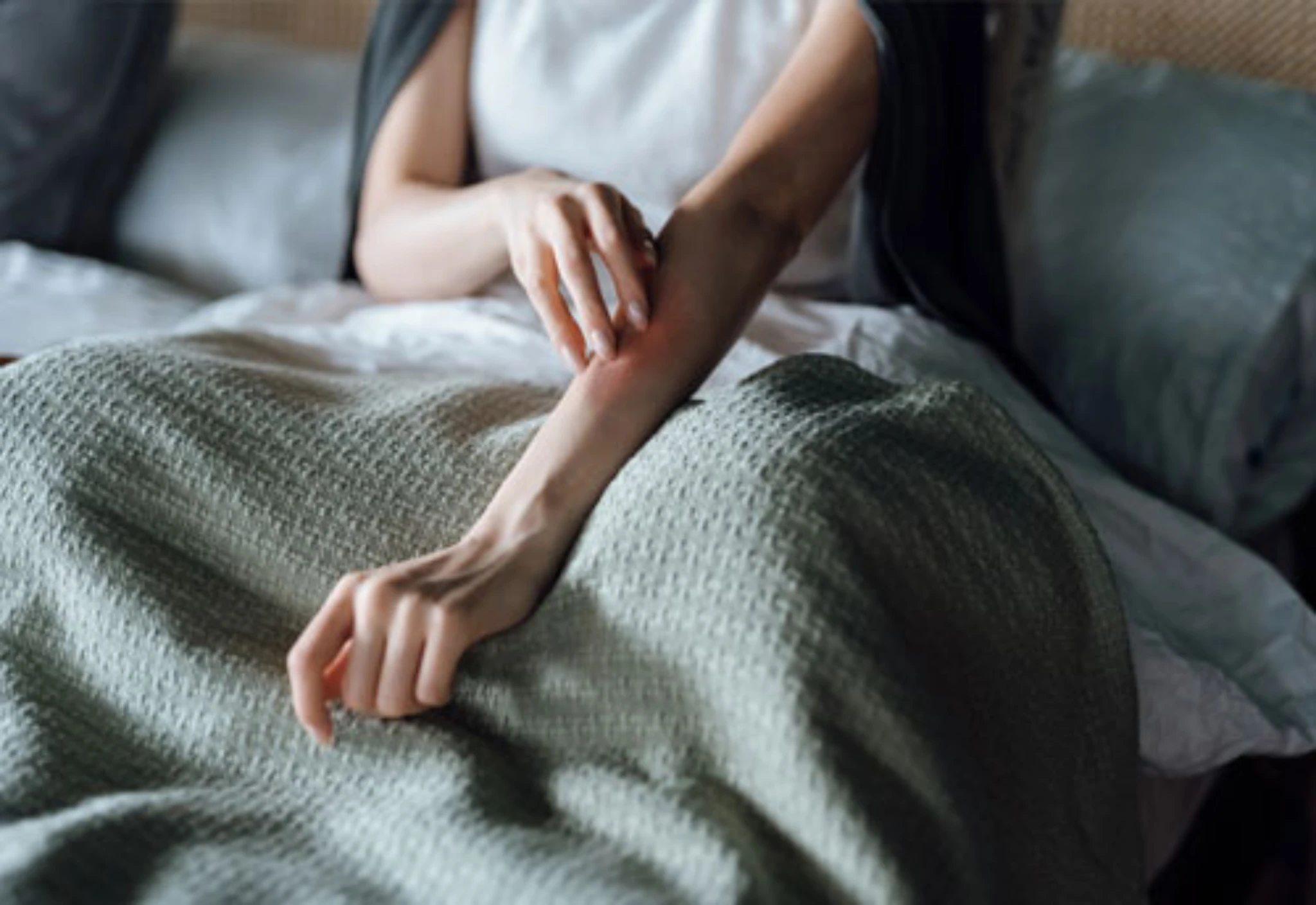 La dermatite atopique et le sommeil