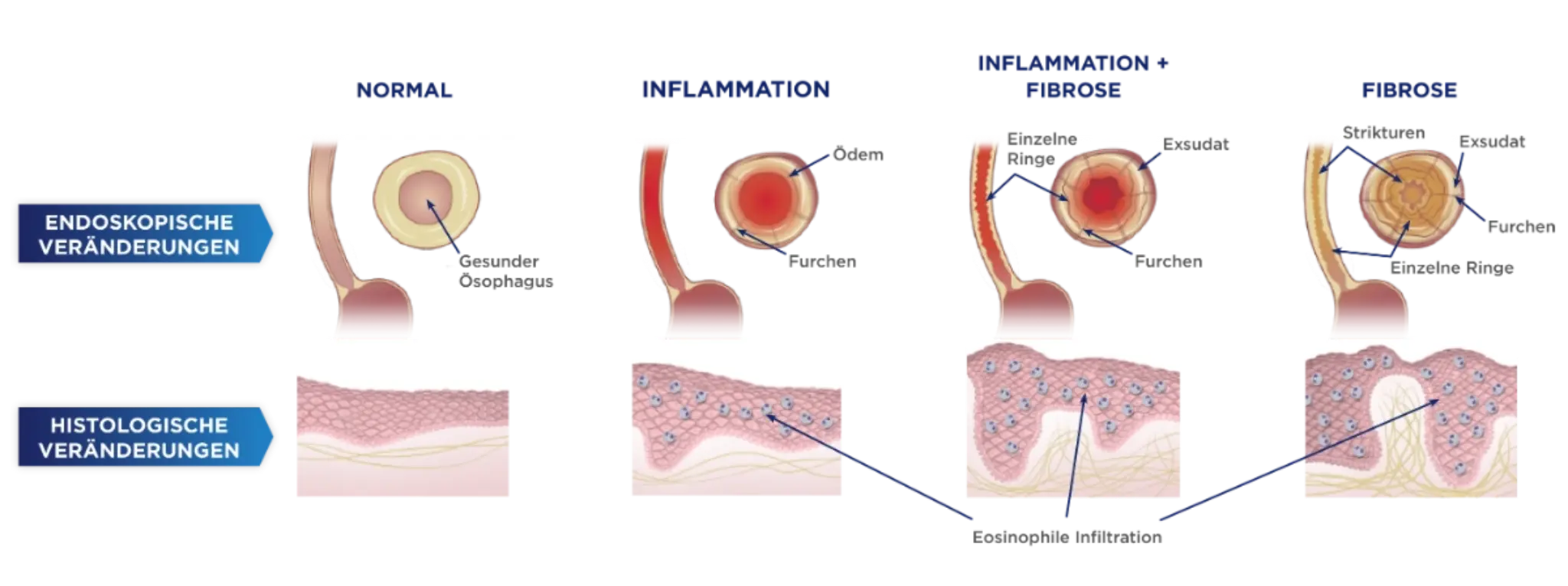 Diagnose & Epidemiologie