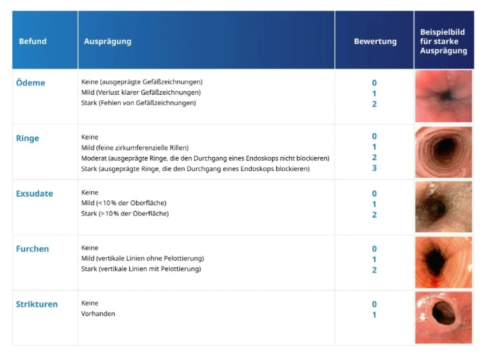 Diagnose & Epidemiologie