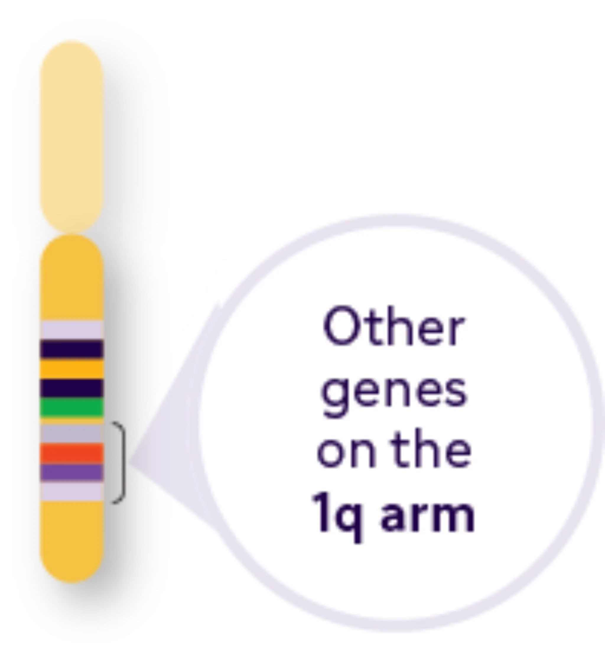 Multiple Myeloma: Chromosome 1q+ cytogenetic abnormalities
