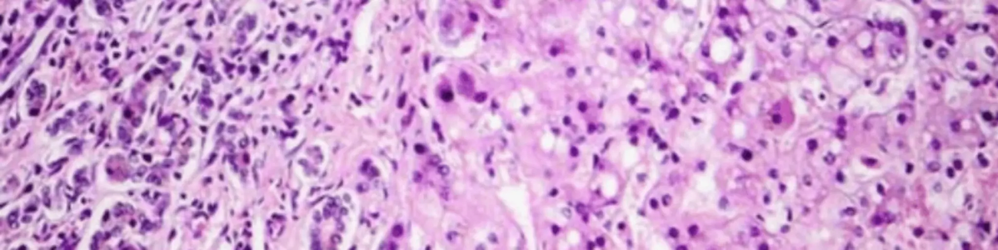 Conceptos generales: qué es ASMD