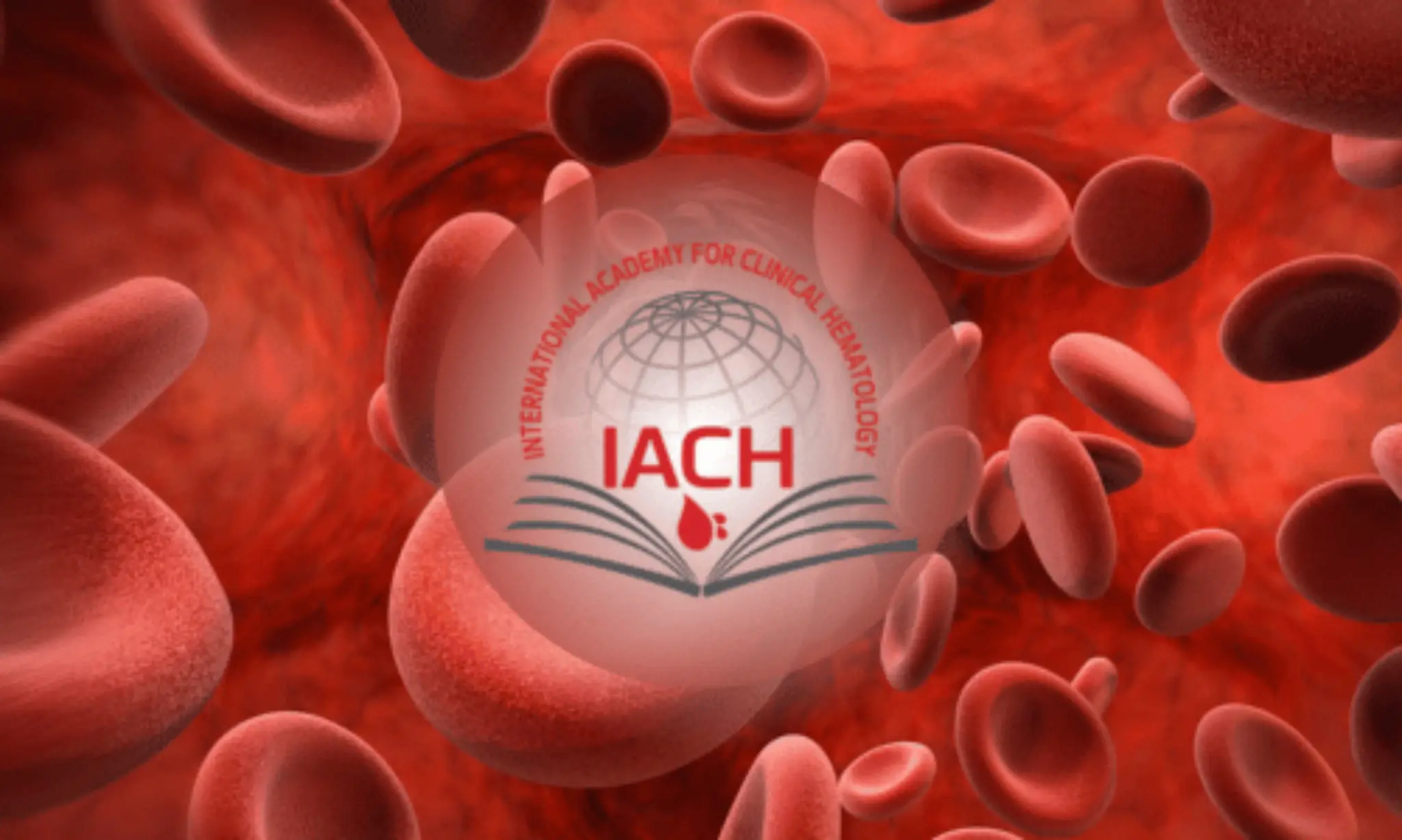 IACH Stem Cell Transplant Academy: Formación en trasplante de células madre