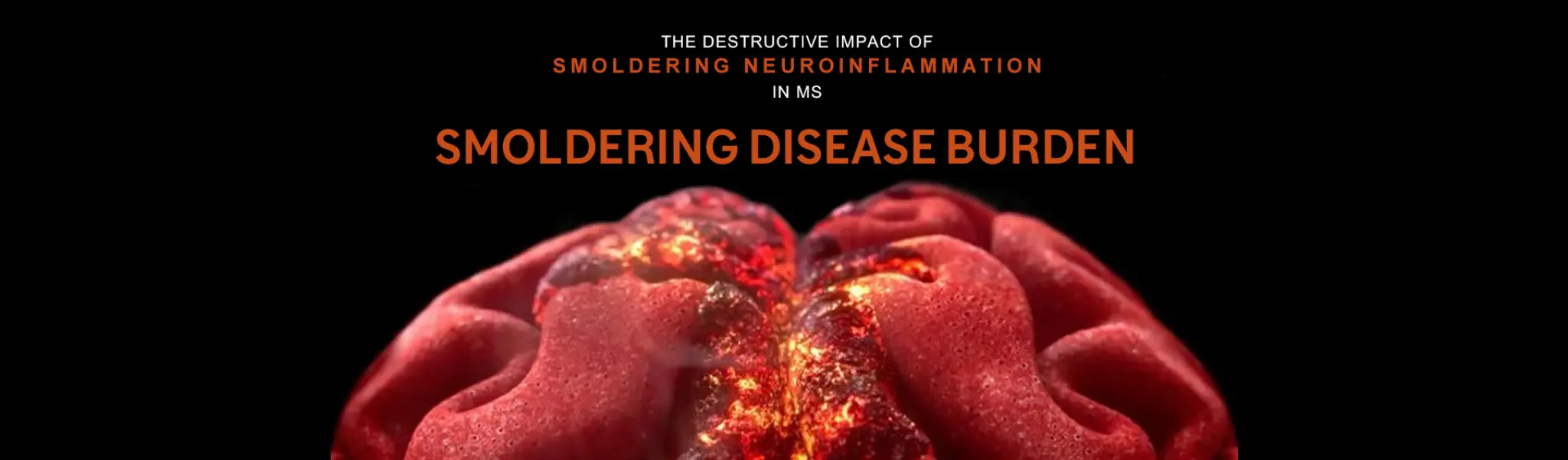 Smoldering Disease Burden in Multiple Sclerosis | Sanofi UAE
