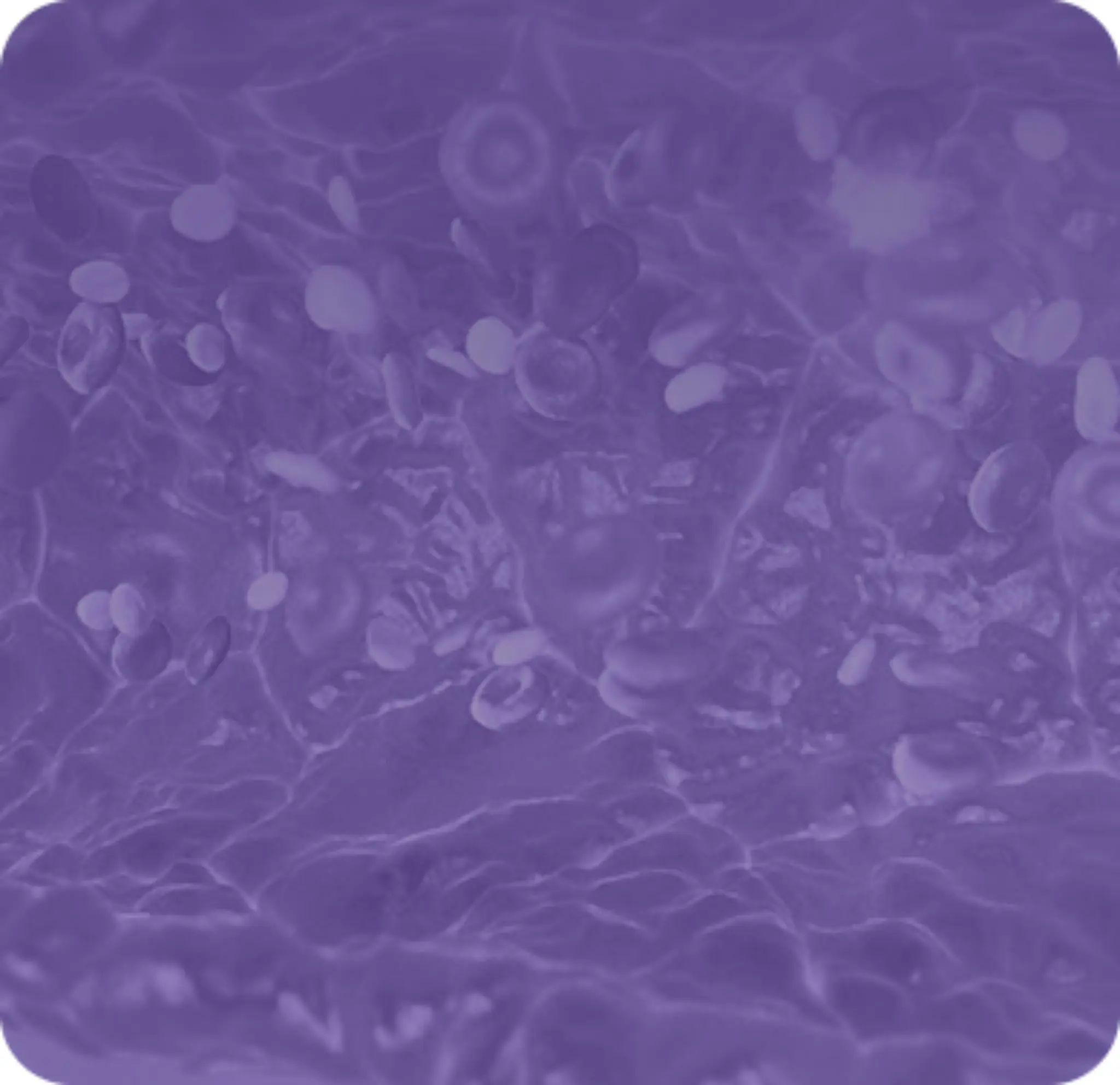 Hemophilia B coagulation Factor IX concentrate for adults and children ...
