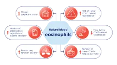 Blood eosinophils as a biomarker for COPD | Campus Sanofi
