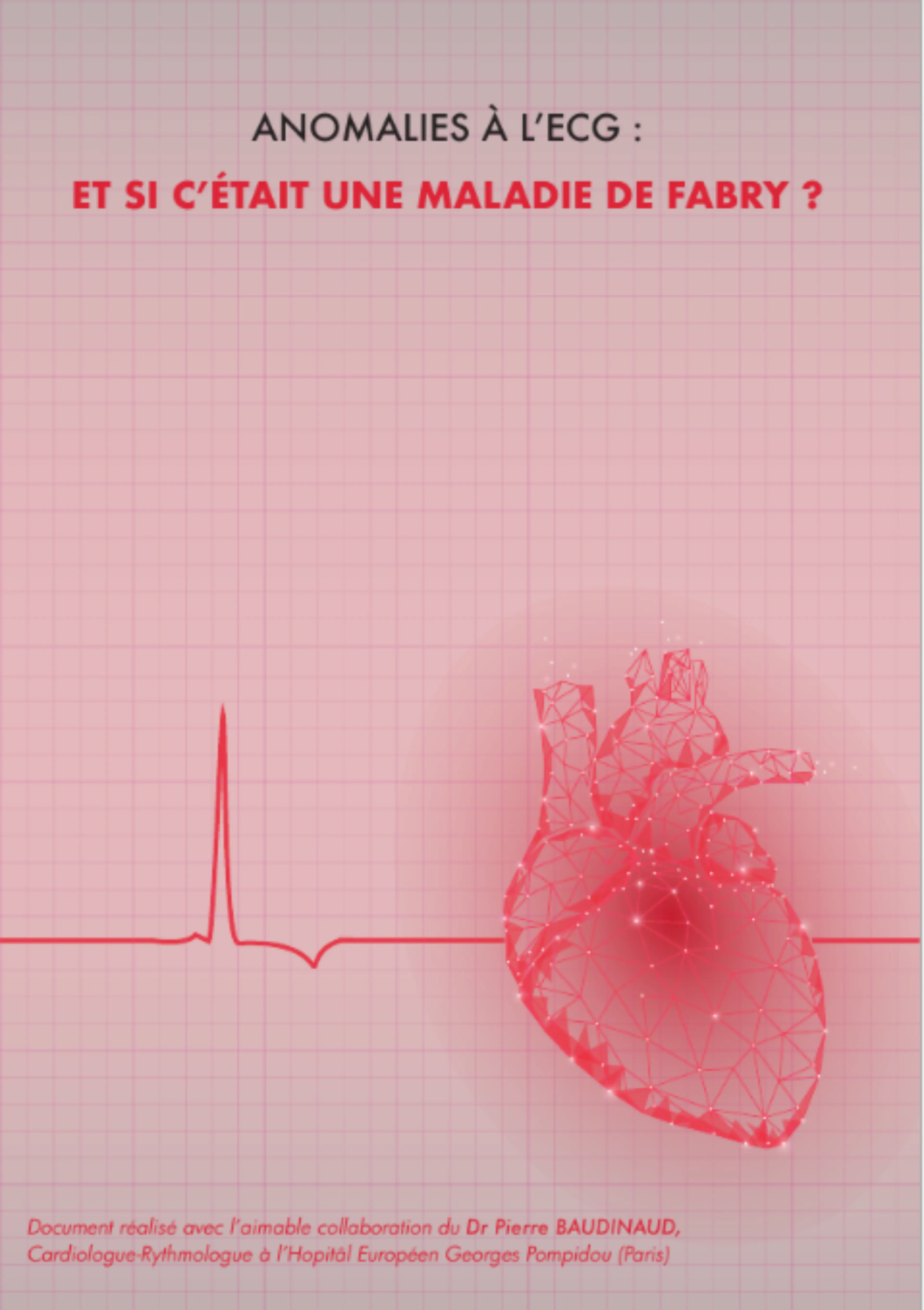 Comment évoquer une maladie de Fabry en cardiologie