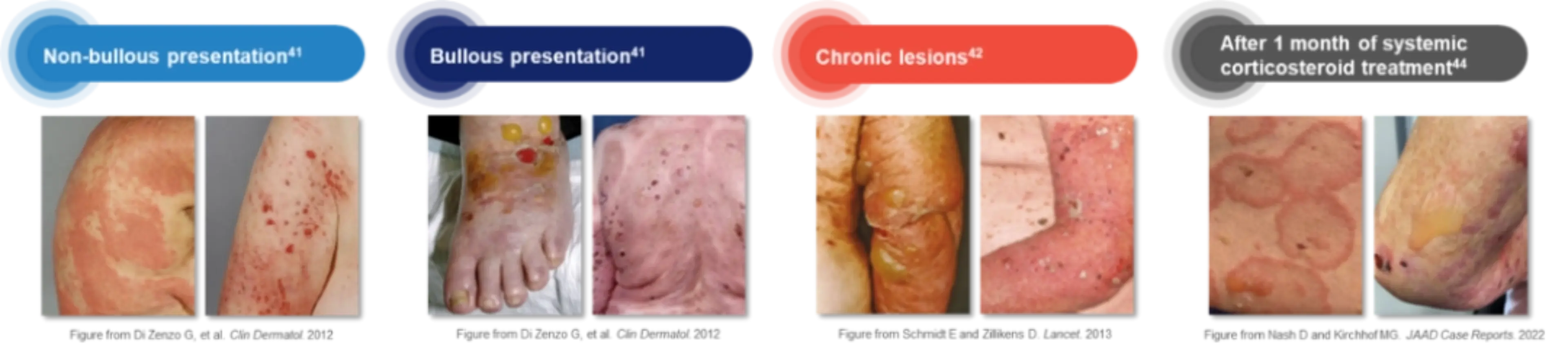 Introduction to Bullous Pemphigoid for HCPs | Sanofi UAE