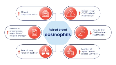 Blood eosinophils as a biomarker for COPD | Campus Sanofi