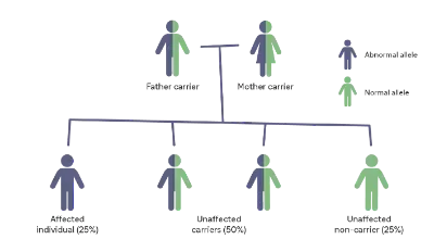 What is Pompe disease - Sanofi Campus UK