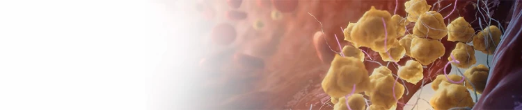 Guías de la ISTH para el diagnóstico y tratamiento de la PTTa