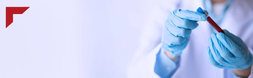 Diagnosi e test della MPS I | LSD | Sanofi Campus Italia